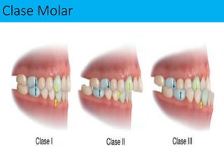 Biotipo facial oclusion.pdf de odontología | PDF
