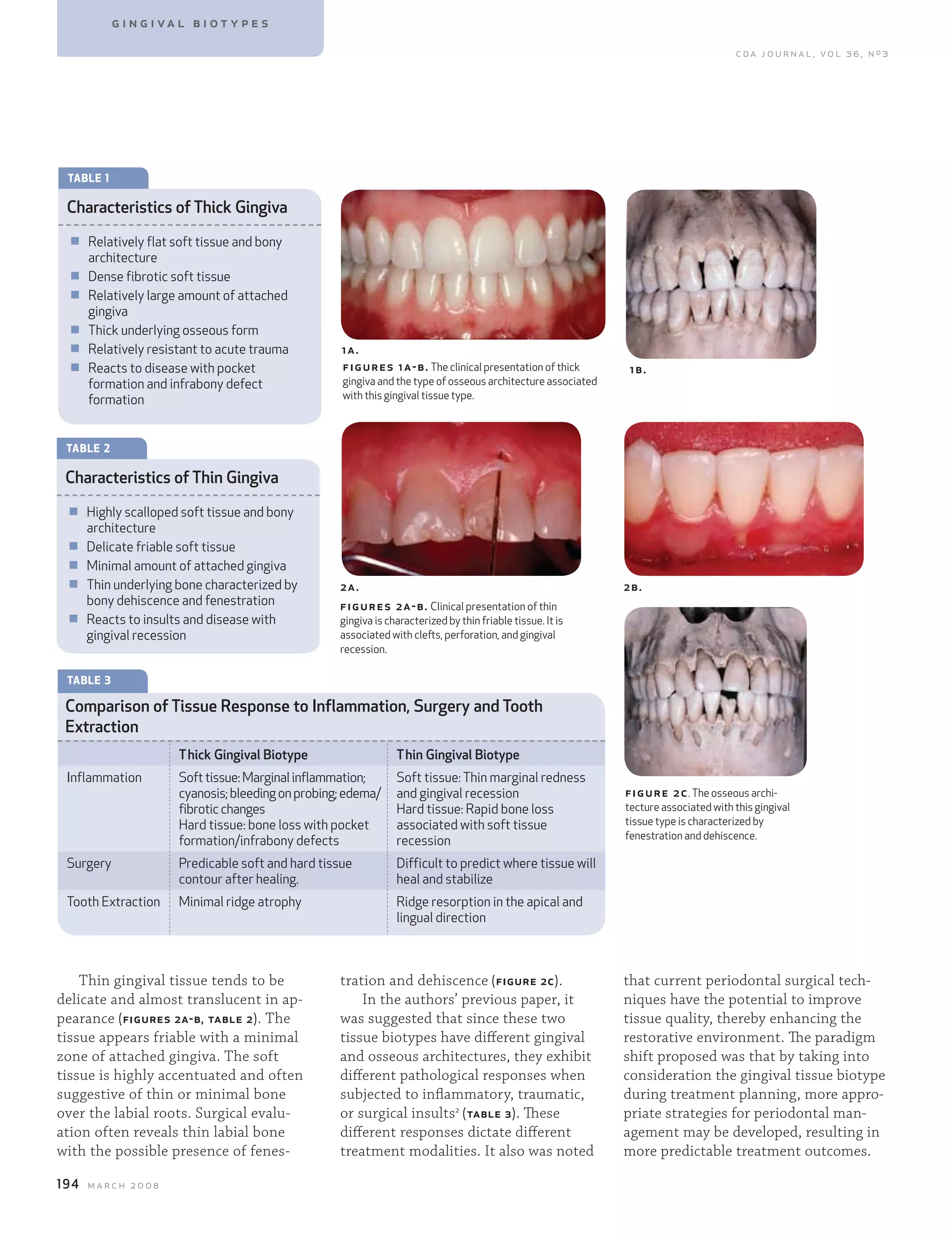 Biotipos periodontales | PDF