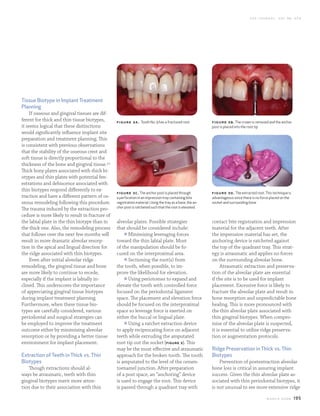 Biotipos periodontales | PDF