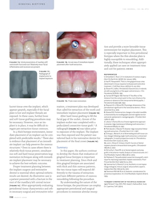 Biotipos periodontales | PDF