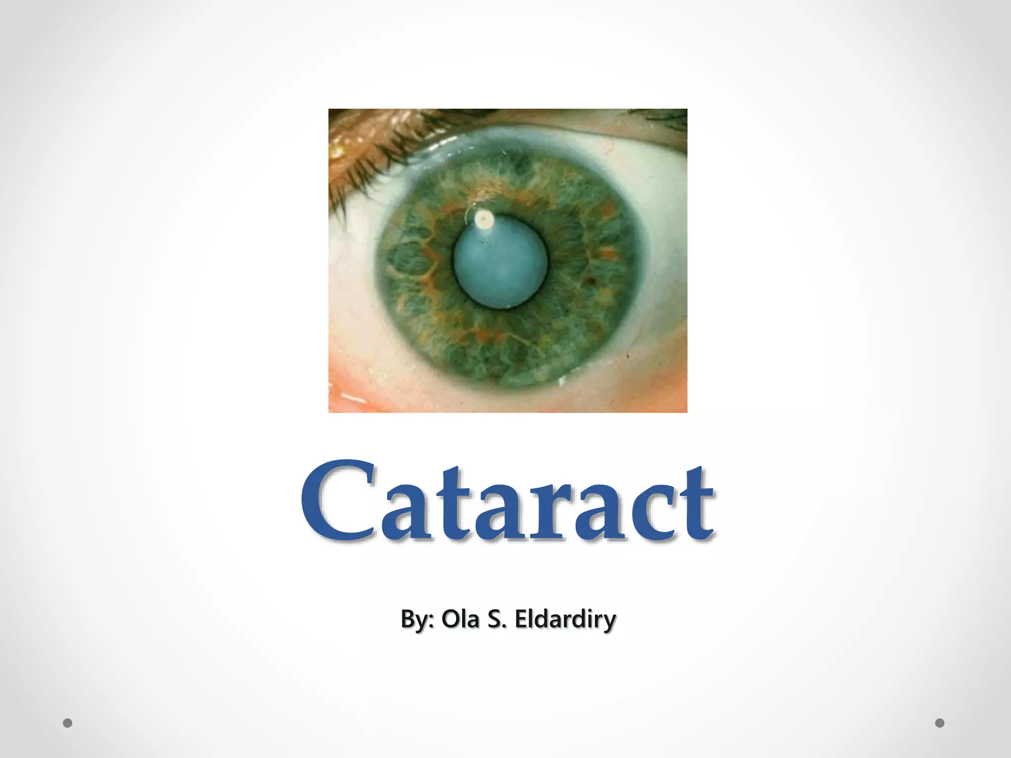 Cataract | PPT