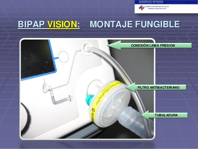 Bipap