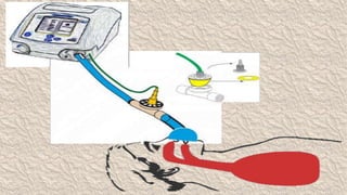 Bi pap machines | PPTX