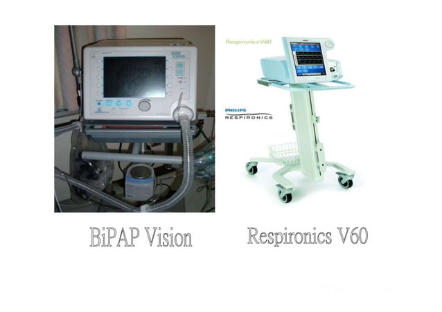 Bi pap -ppt | PPTX | Lung and Respiratory Health | Diseases and Conditions