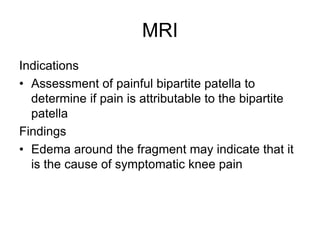 Biparatite patella | PPTX