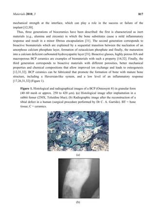 Biphasic calcium phosphate ceramics for bone regeneration | PDF