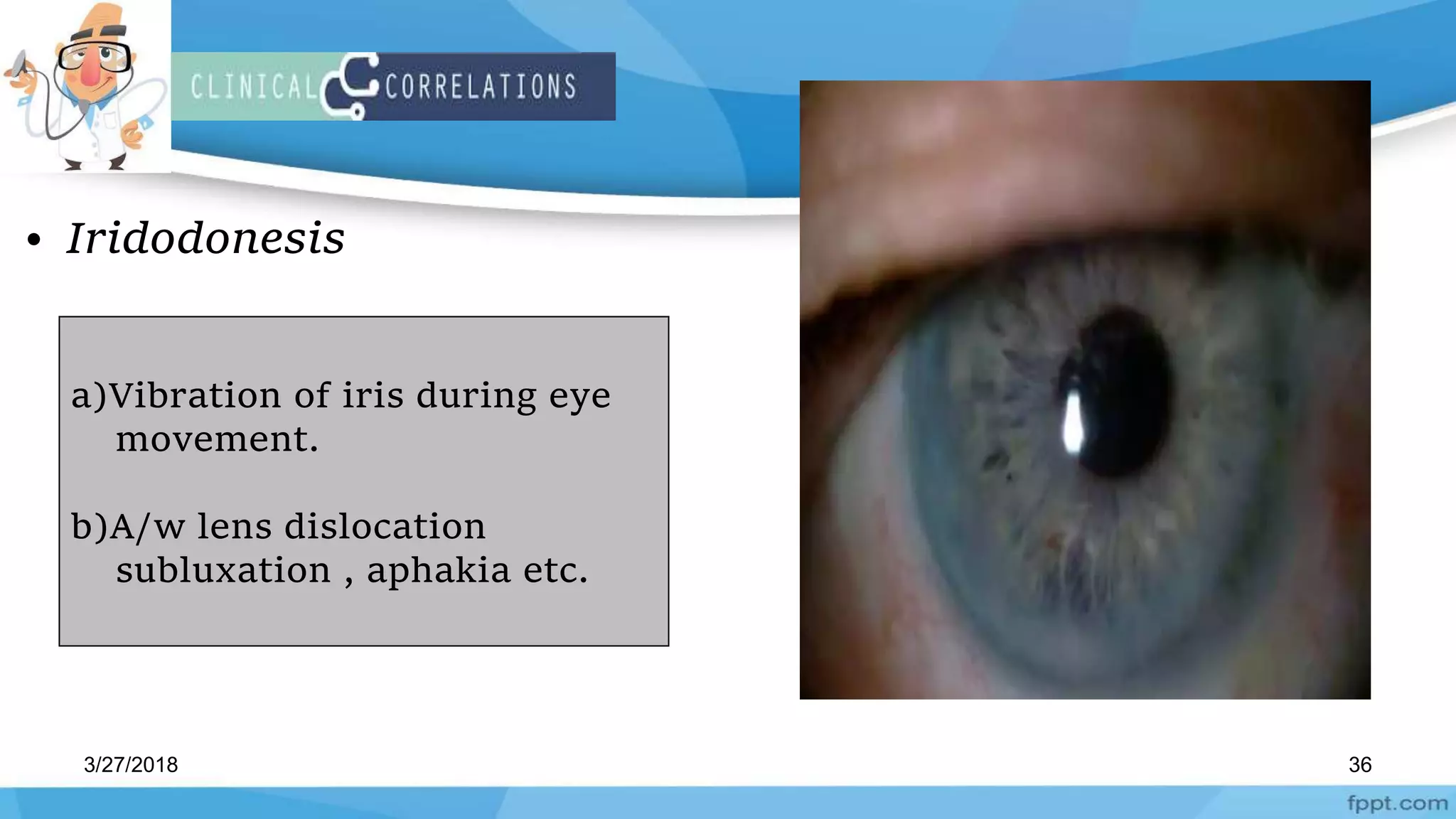 Real Anatomy of UVEA. | PPT