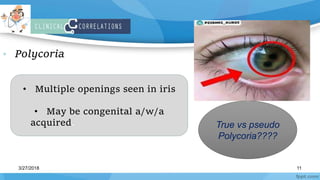 Real Anatomy of UVEA. | PPTX