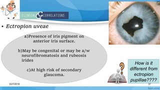 Real Anatomy of UVEA. | PPTX