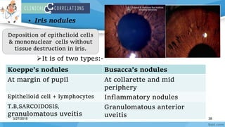 Real Anatomy of UVEA. | PPTX