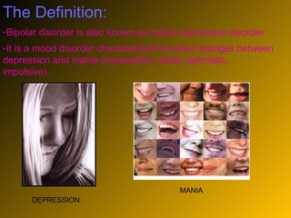 Bipolar | PPT