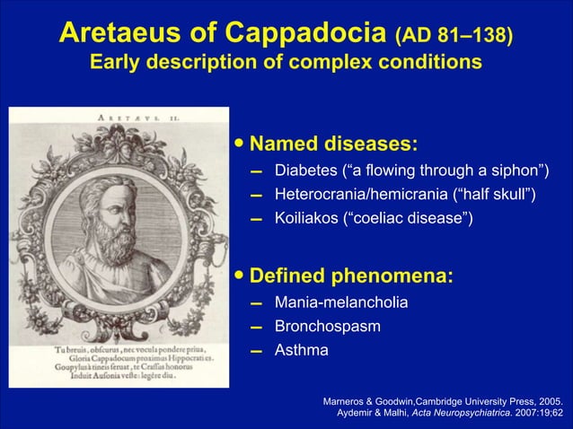 Bipolar a complex disorder | PPT