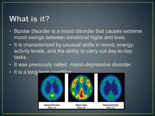 Bipolar Disorder | PPT