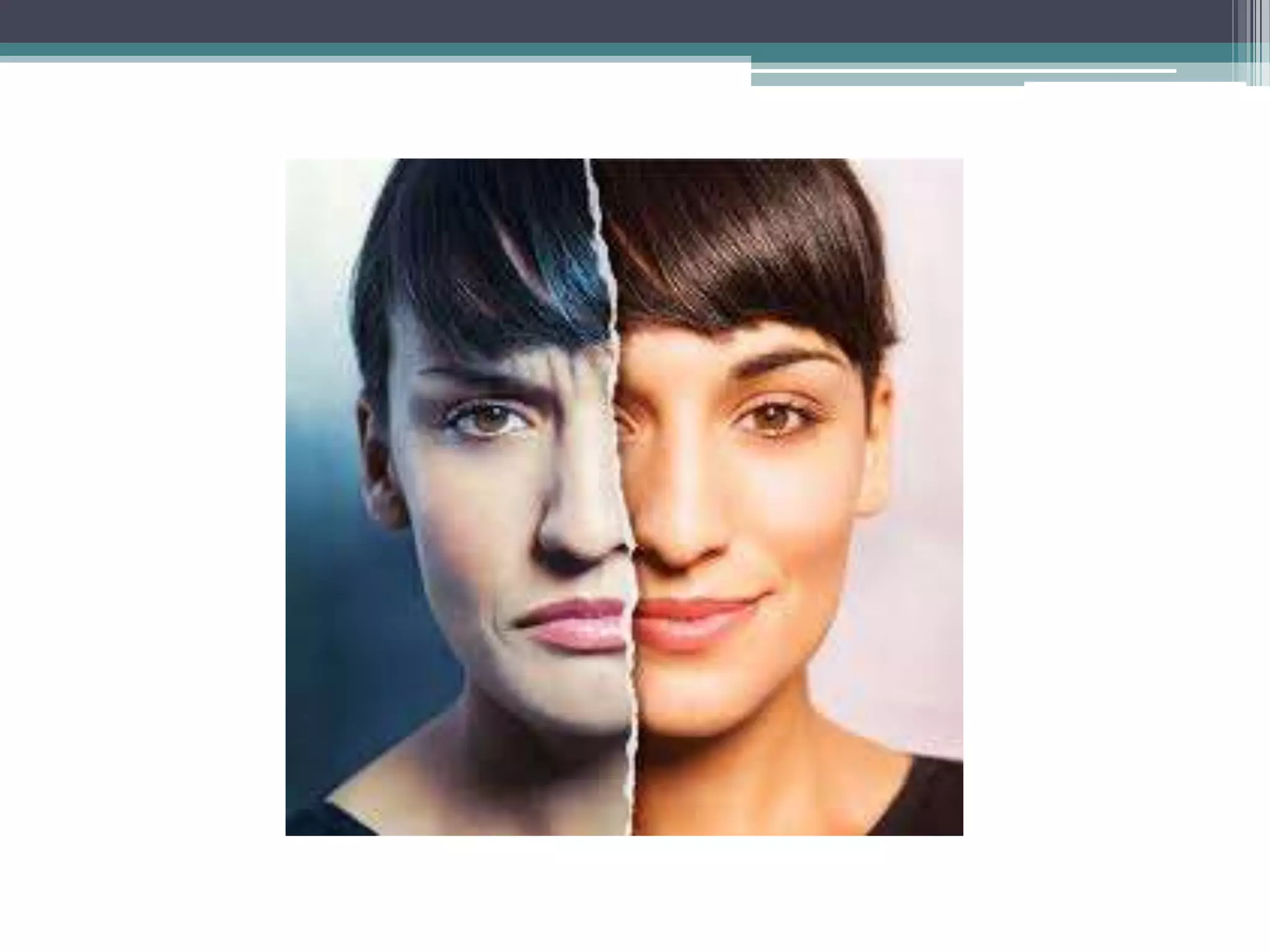 Bipolar disorders | PPTX