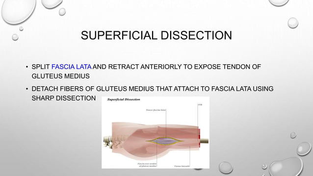 BIPOLAR HEMIARTHROPLASTY (1).pptx