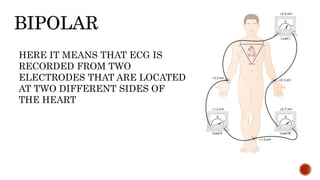 BIPOLAR LIMB LEADS.pptx