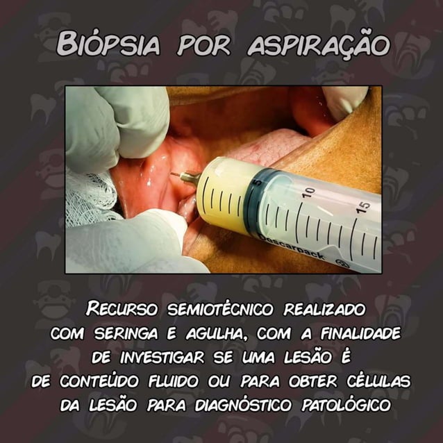 Biópsias em Odontologia - Incisional, Excisional, Punch, Citologia Es…