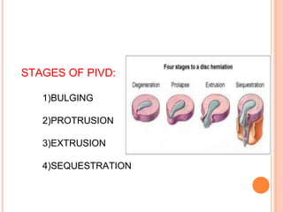 Bipul sir pivd presentation | PPTX