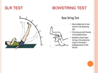 Bipul sir pivd presentation | PPTX