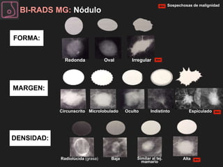 BIRADS.pptx