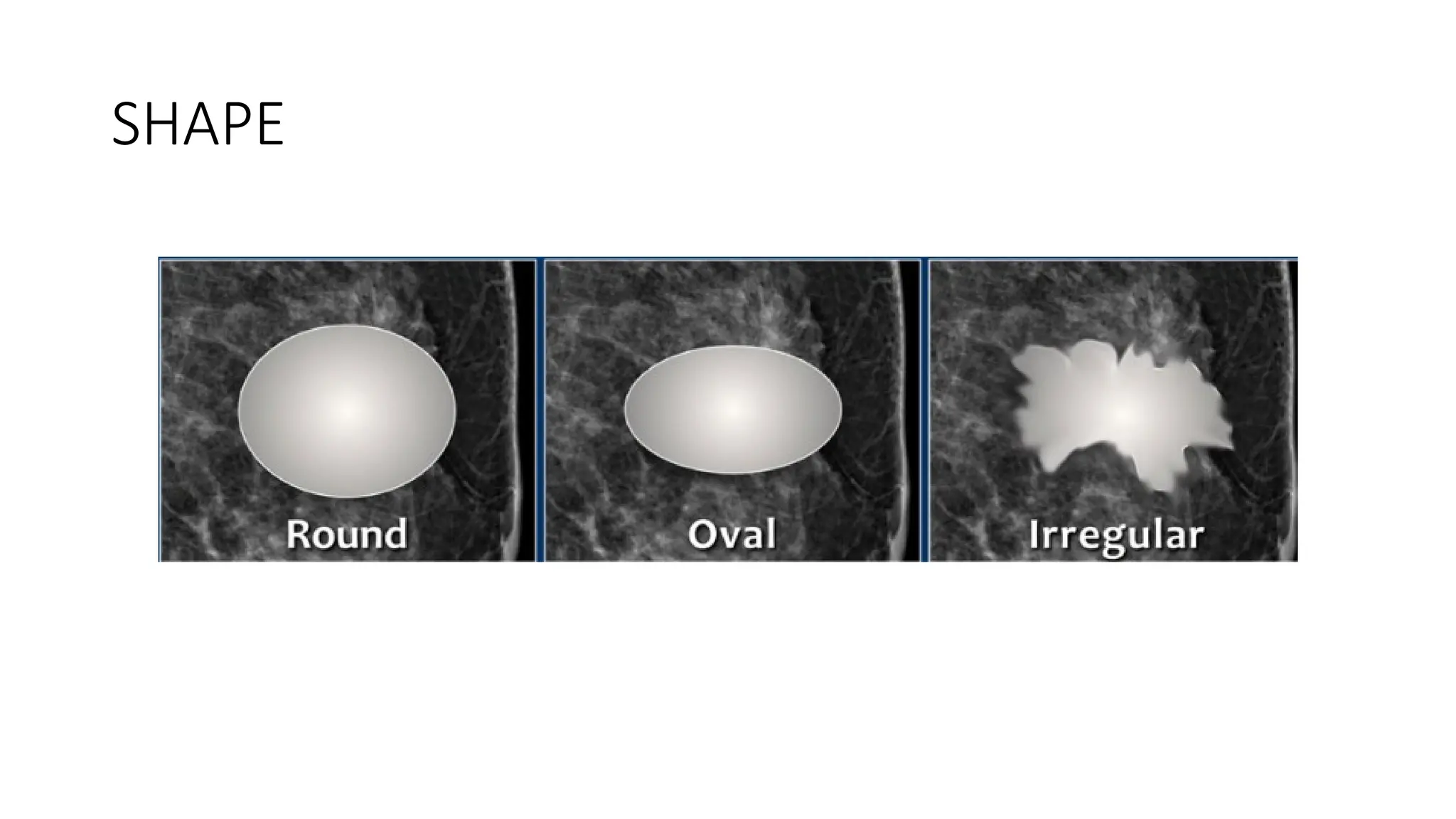 BIRADS mammogram and usg lexicon review.pptx