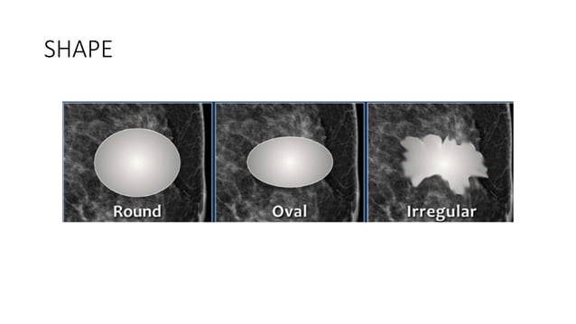 BIRADS mammogram and usg lexicon review.pptx