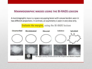 BI-RADS in Mammography by UROOJ Mushtaq Bhat.pptx