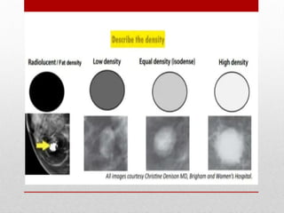 BI-RADS in Mammography by UROOJ Mushtaq Bhat.pptx