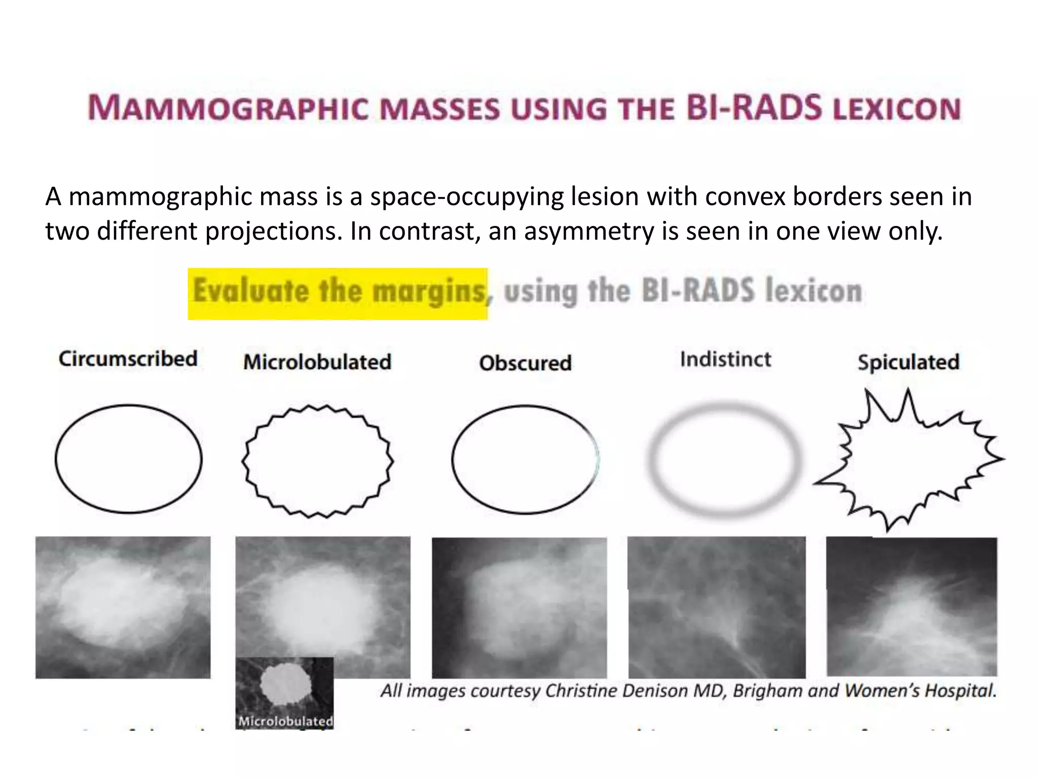 BIRADS, Breast Ultrasound, mamography | PPTX