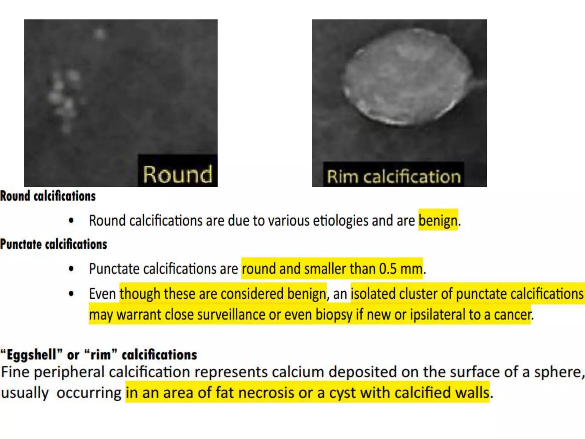 BIRADS, Breast Ultrasound, mamography | PPTX