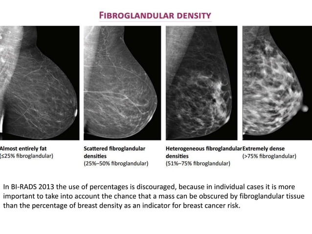 BIRADS, Breast Ultrasound, mamography | PPTX