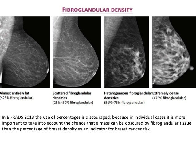 BIRADS, Breast Ultrasound, mamography