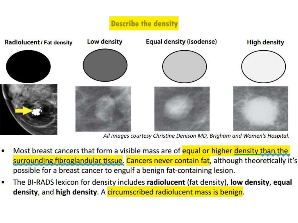 BIRADS, Breast Ultrasound, mamography