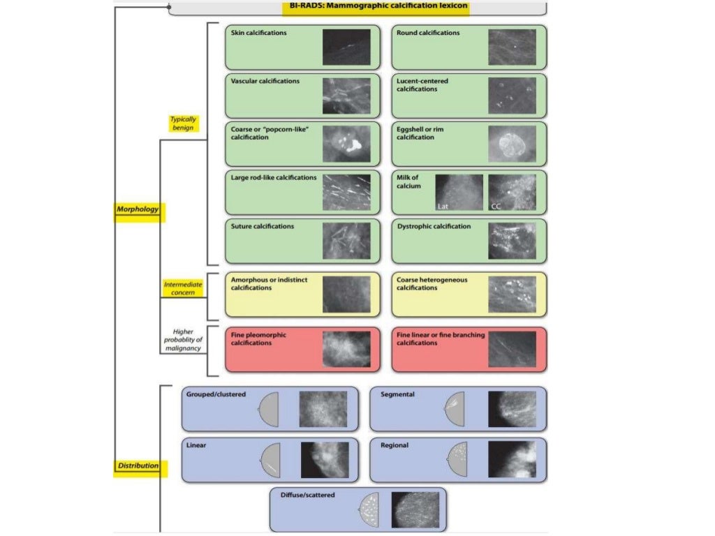 BIRADS, Breast Ultrasound, mamography
