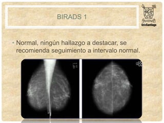 BIRADS mamografia final, y. Sus clasificaciones | PPTX
