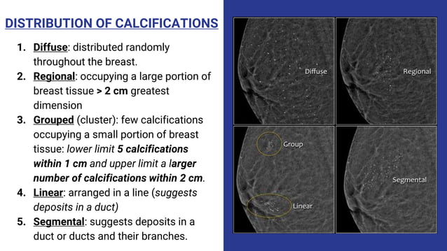 Birads sono-mammography | PPTX