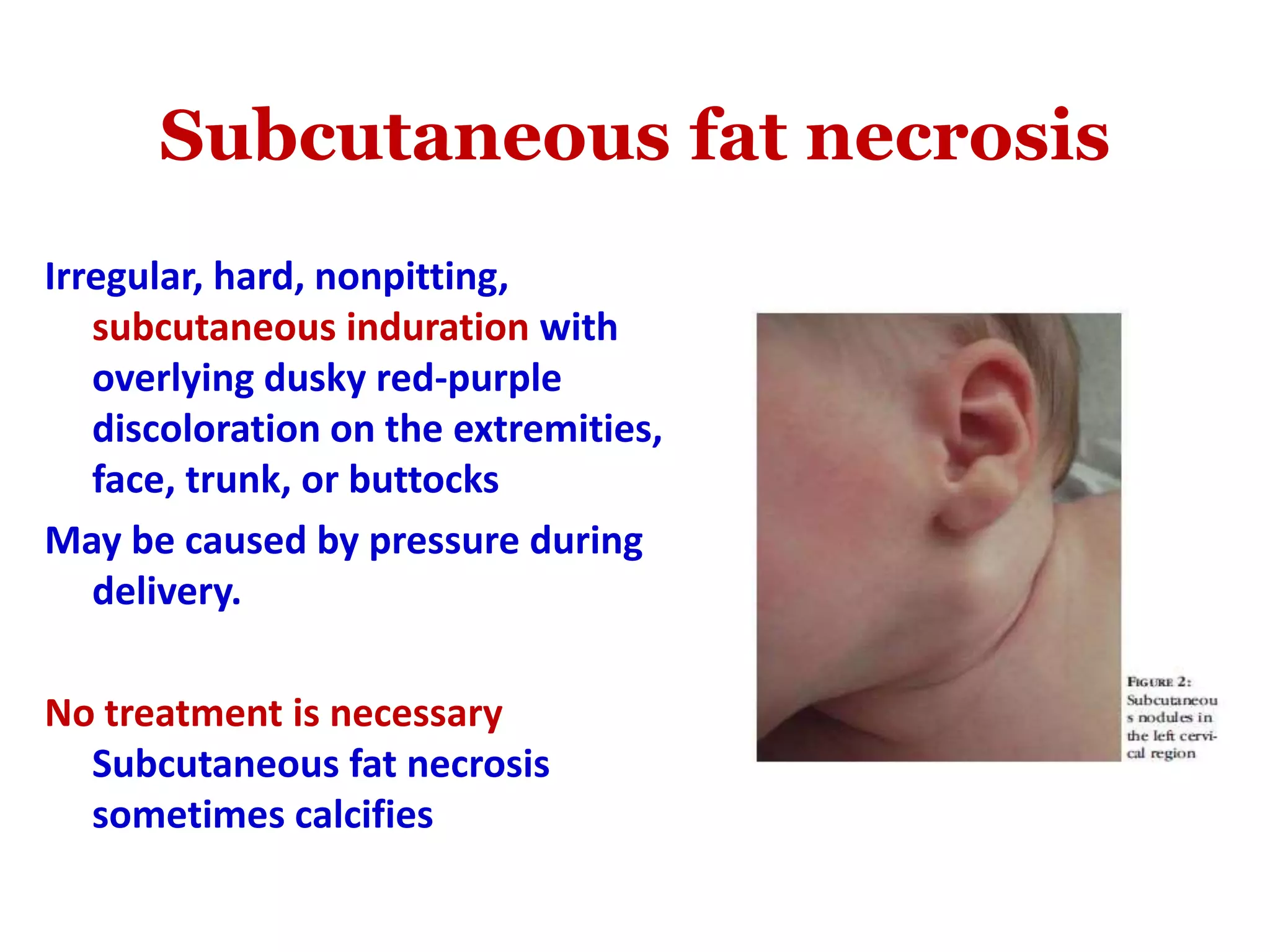 Birth injuries | PPTX