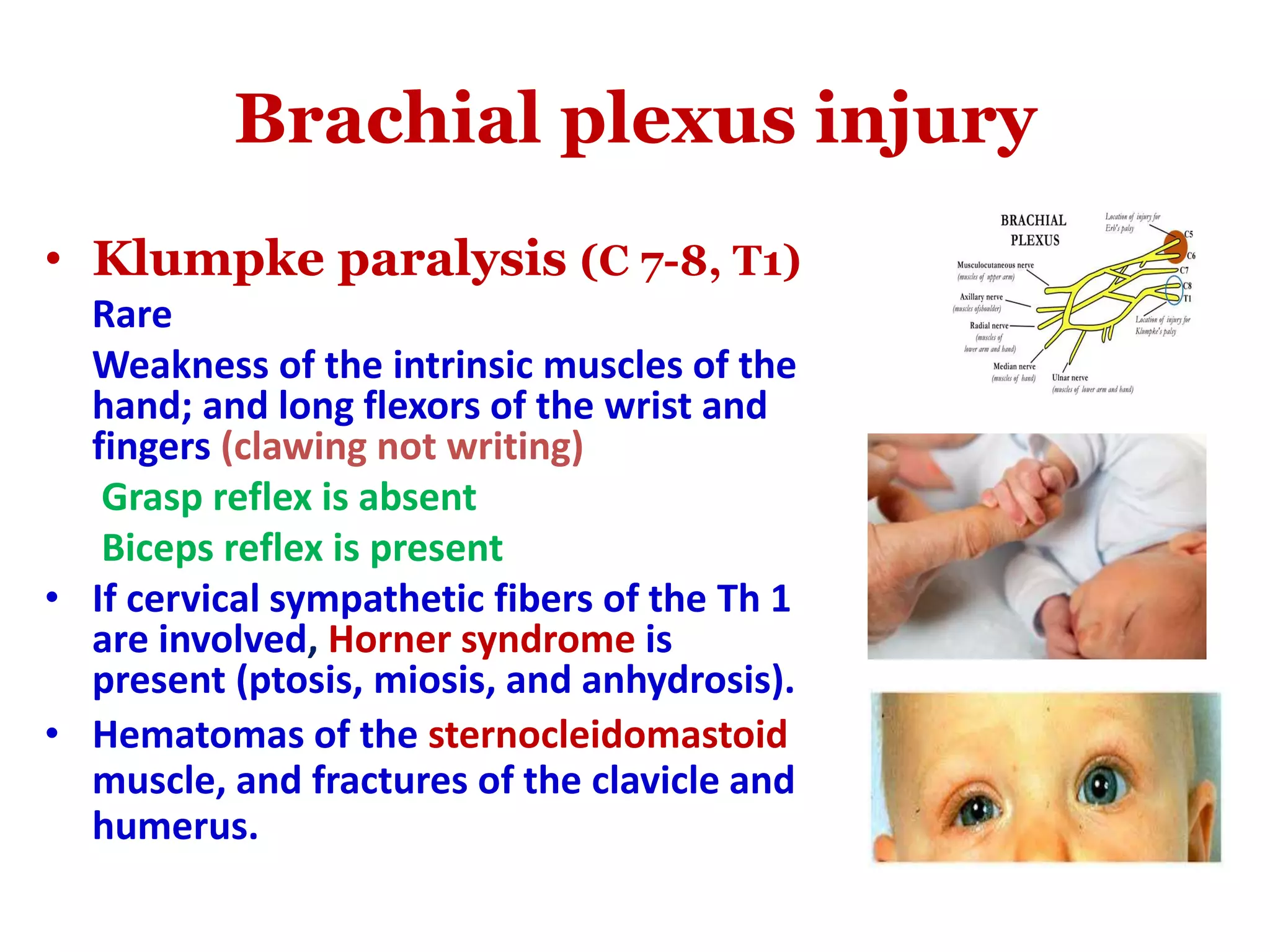 Birth injuries | PPTX