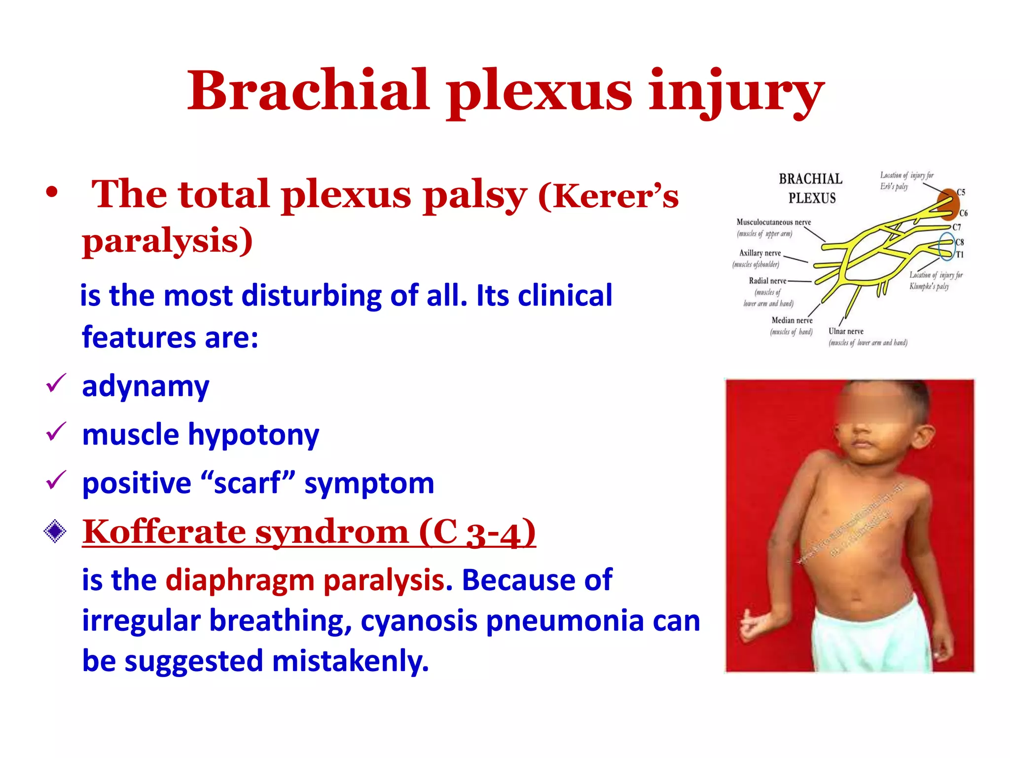 Birth injuries | PPTX