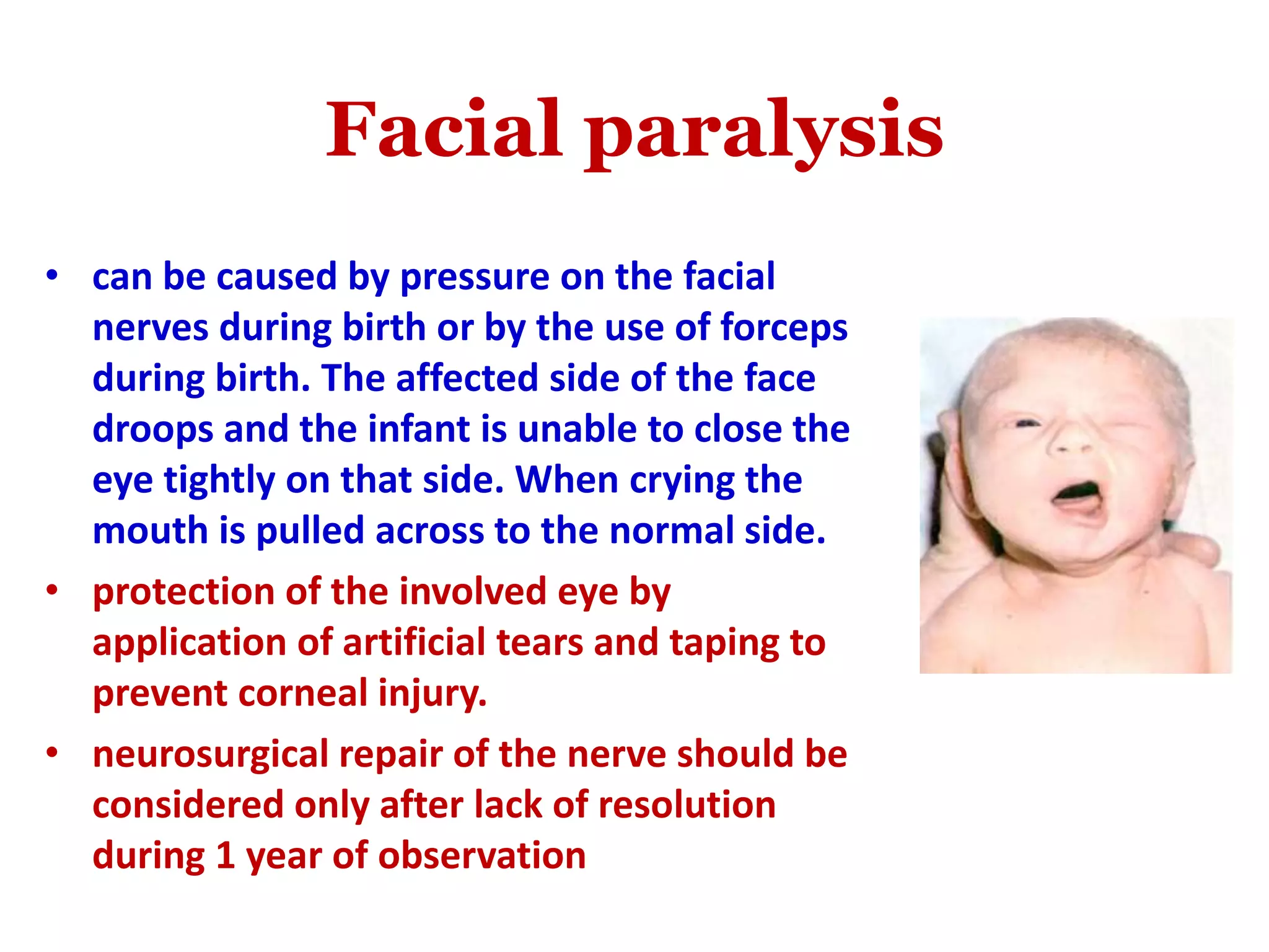Birth injuries | PPTX