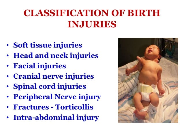 Birth injuries