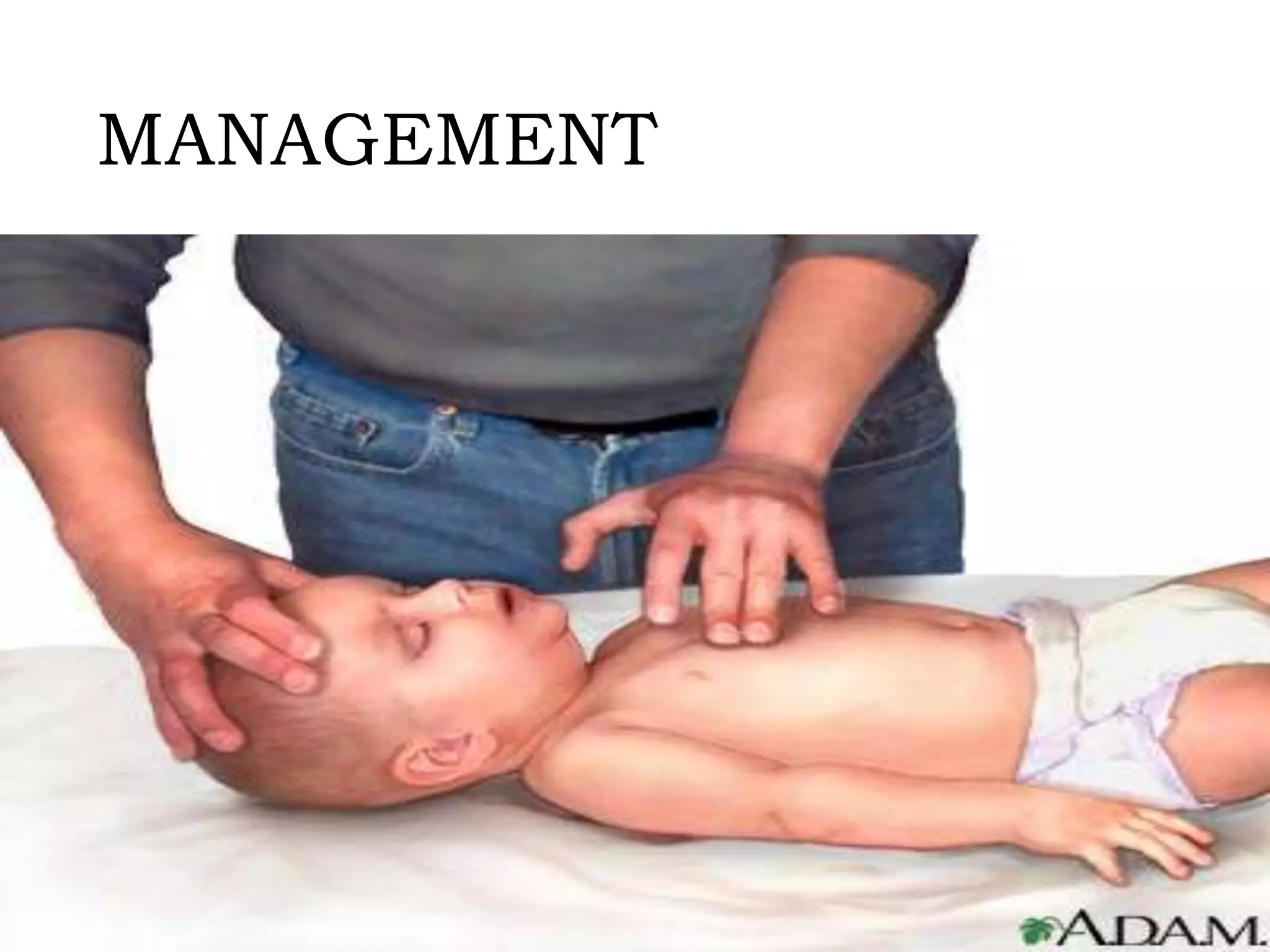 Birth Asphyxia.pptx