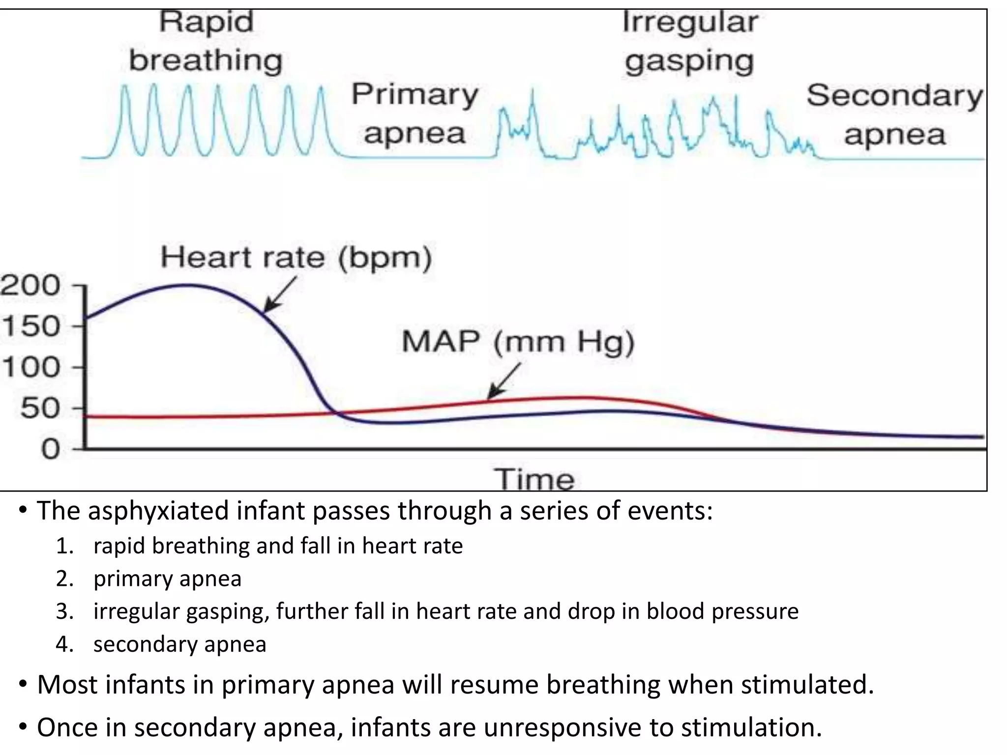 Birth Asphyxia.pptx