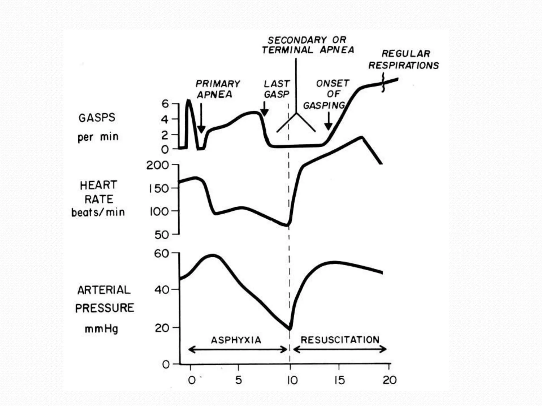 Birth asphyxia management | PPTX
