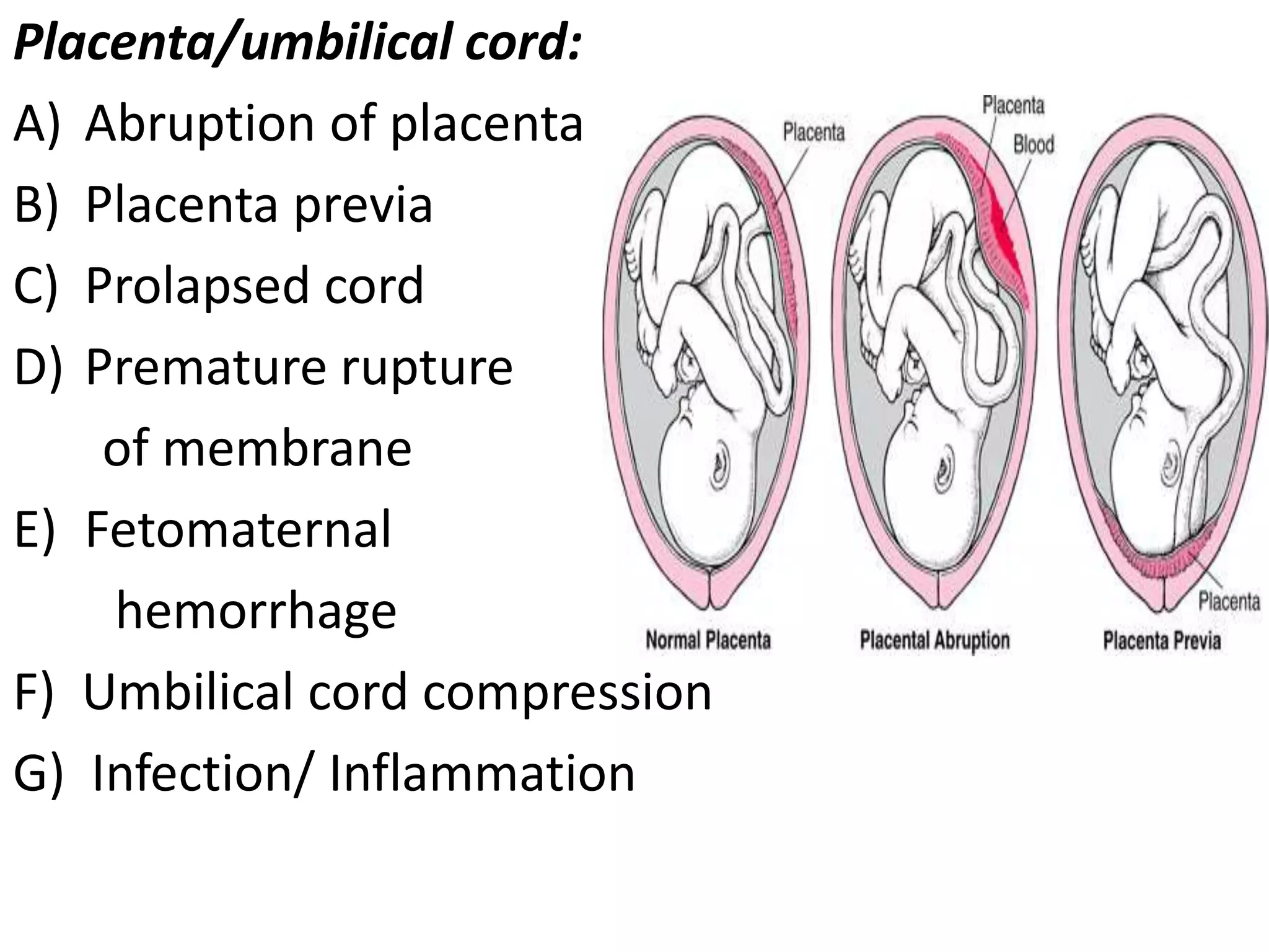 Birth Asphyxia (1) (1).pptx