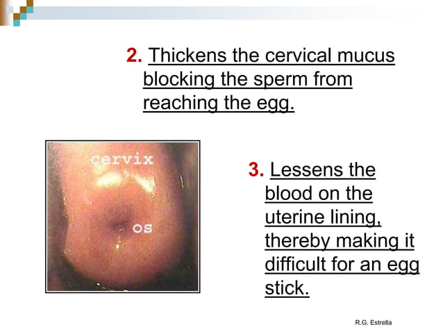 Contraception | PPTX | Birth Control | Reproductive Health
