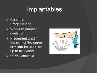 Birth control informative speech powerpoint | PPTX
