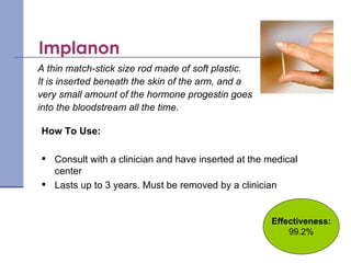 Birth Control Methods | PPT