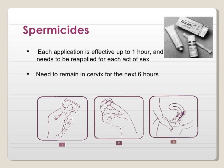 Birth Control Methods