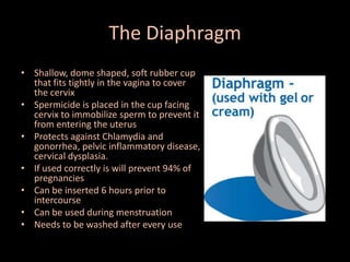 Birth control slide show | PPTX